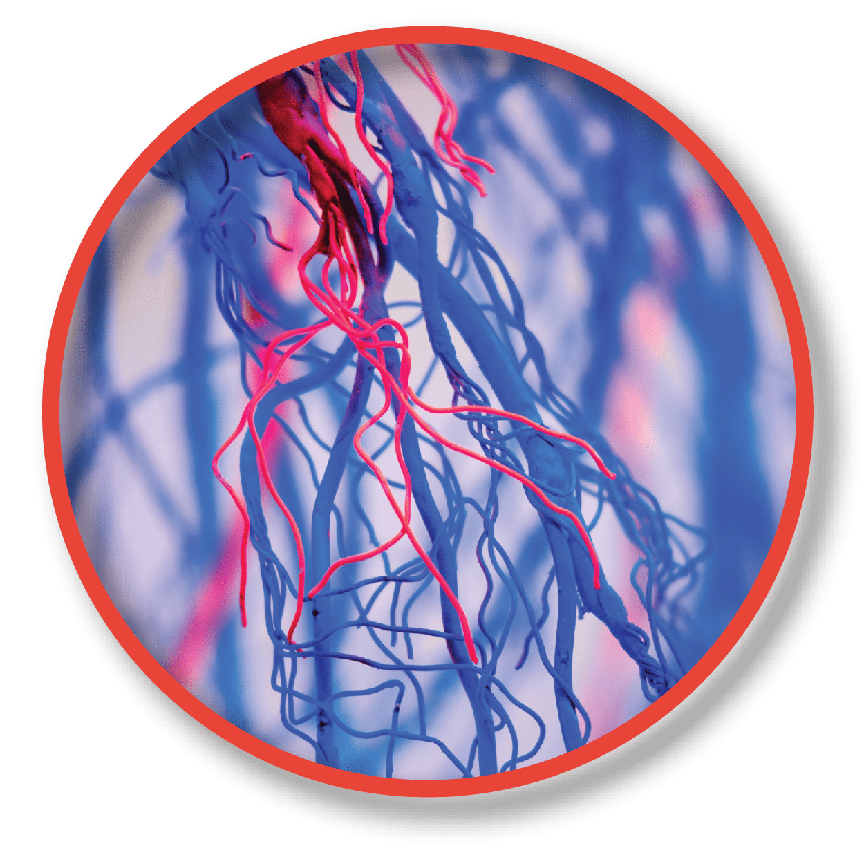 Varicose Veins - New England Endovascular Center